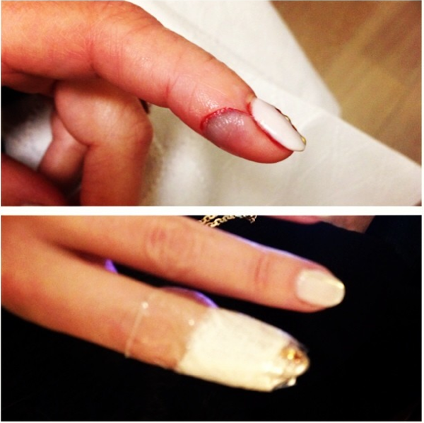 Giada De Laurentiis cuts finger open during TV special