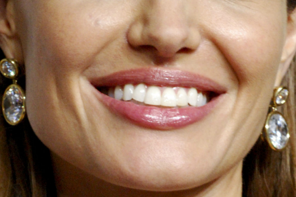 Best Smile With Teeth