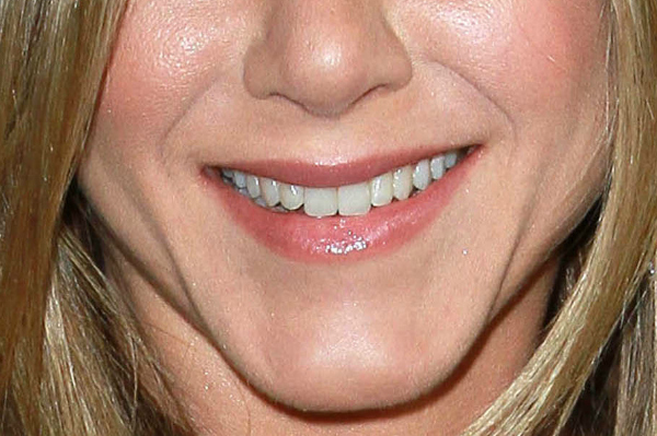 Can you decode the most recognizable smiles in Hollywood?